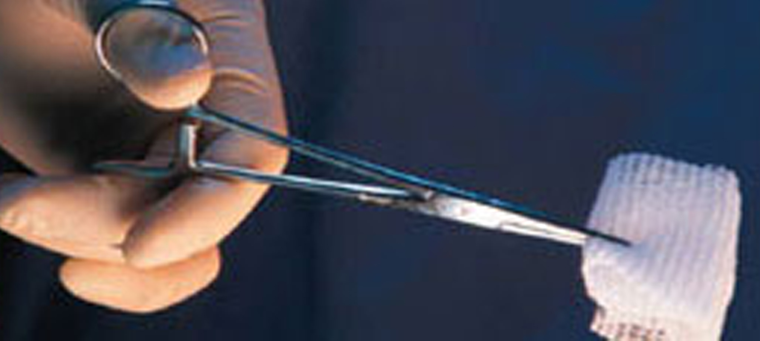 The One That Got Away - Patients Often Exit Surgery With "Retained ...